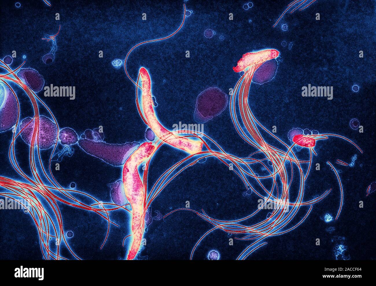 Spirochete bacteria, coloured transmission electron micrograph (TEM ...