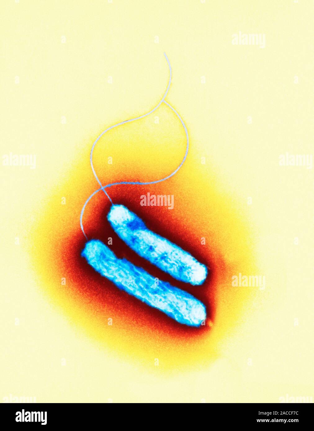 Campylobacter bacteria. Coloured transmission electron micrograph (TEM ...