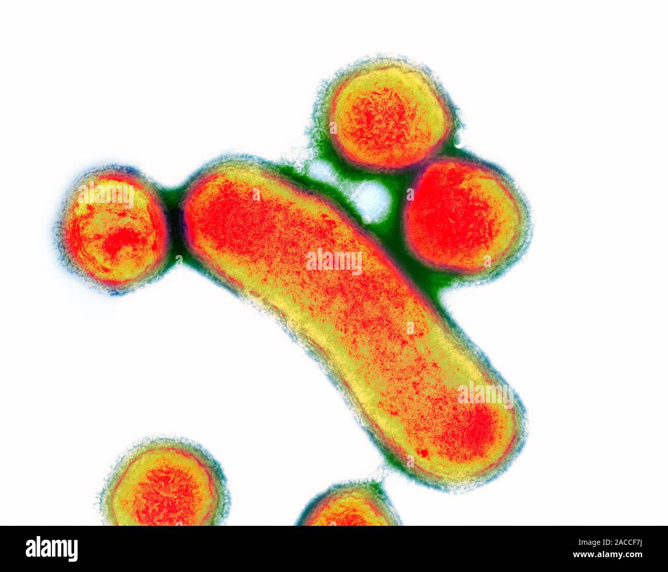 Porphyromonas bacteria. Coloured transmission electron micrograph (TEM ...