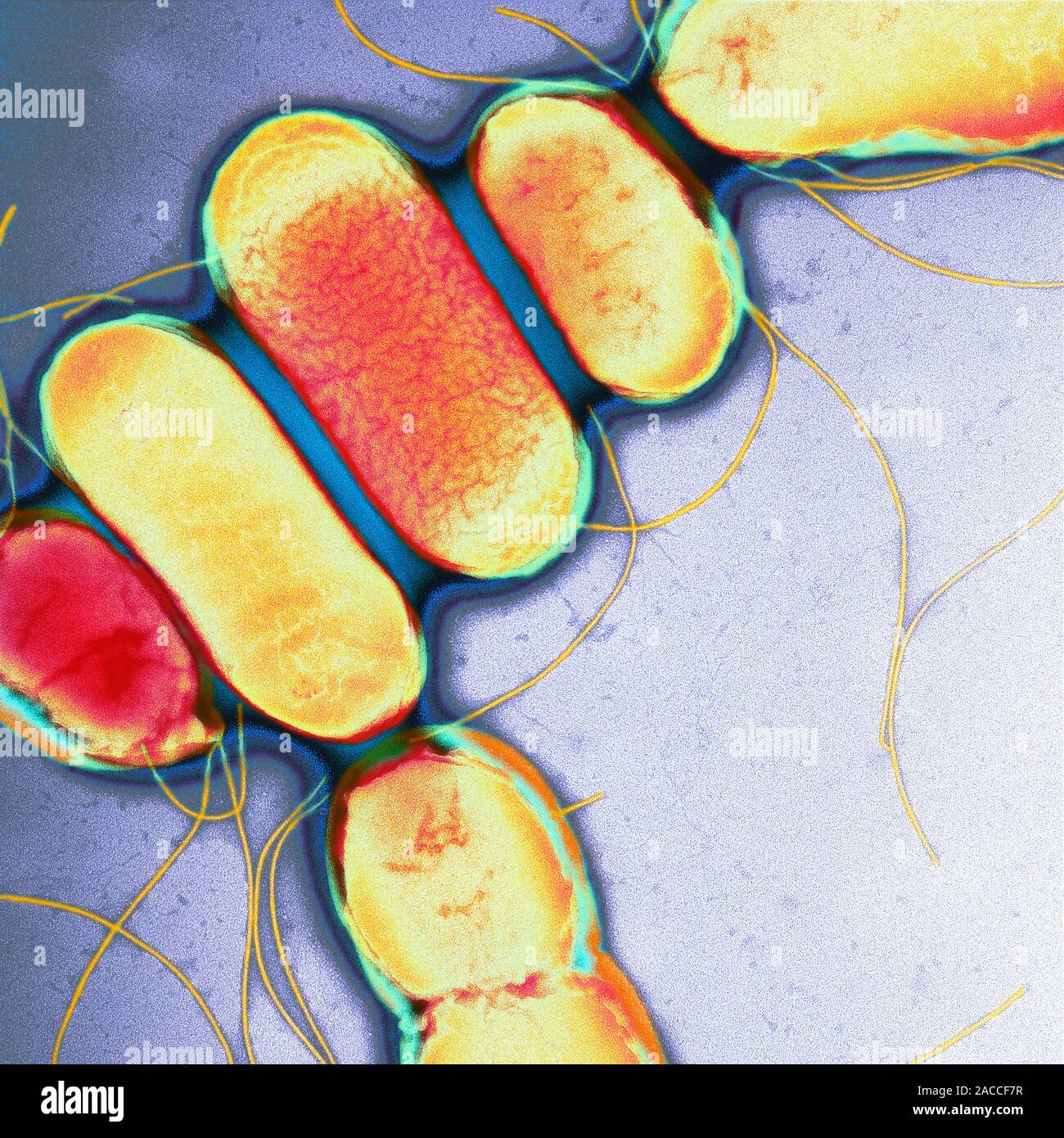 Salmonella. Coloured transmission electron micrograph (TEM) of ... Salmonella. Coloured transmission electron micrograph (TEM) of ...