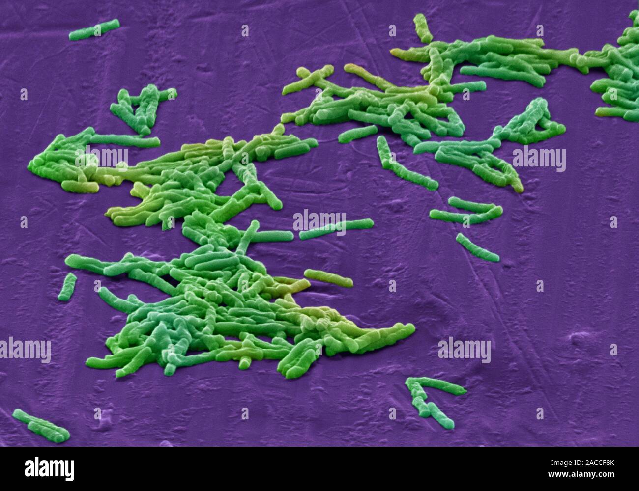 Clostridium difficile bacteria, coloured scanning electron micrograph ...