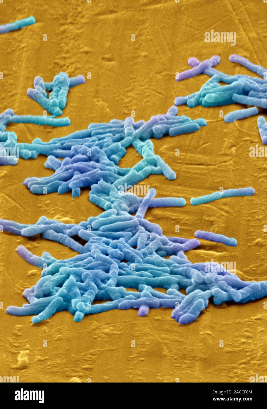 Clostridium Difficile Bacteria Coloured Scanning Electron Micrograph Sem These Rod Shaped
