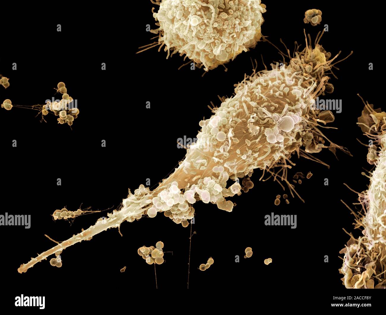 Epithelial Gonorrhoea Infection Coloured Scanning Electron Micrograph Sem Of Neisseria