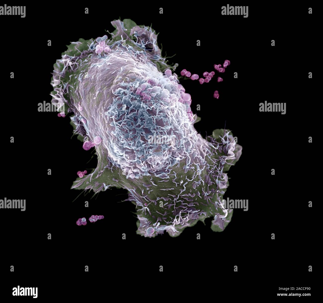 Epithelial Gonorrhoea Infection Coloured Scanning Electron Micrograph Sem Of Neisseria