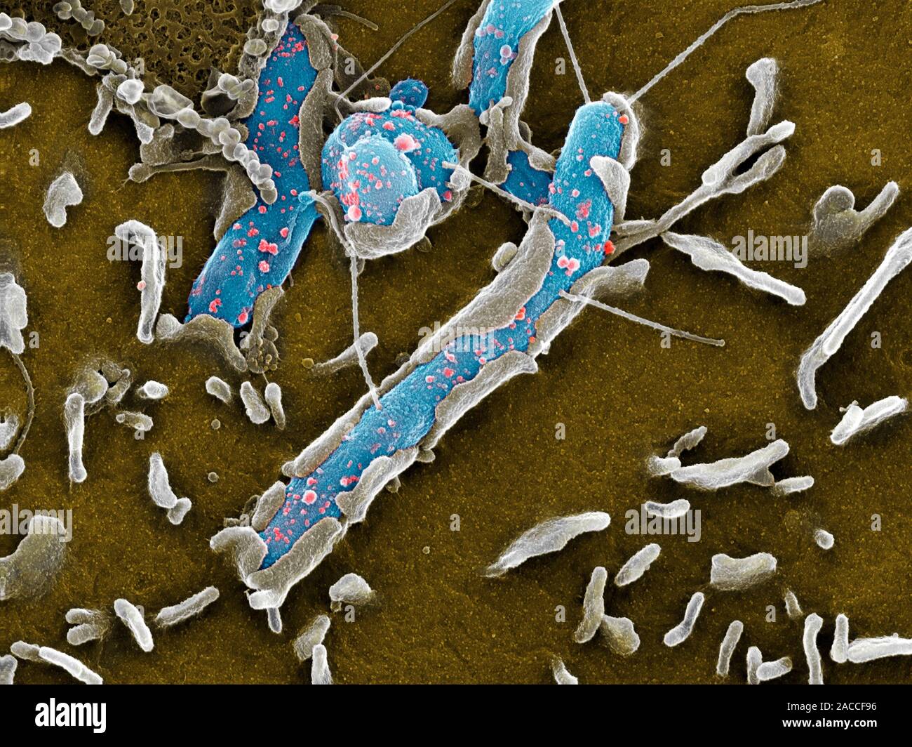 Helicobacter pylori bacteria. Coloured scanning electron micrograph ...