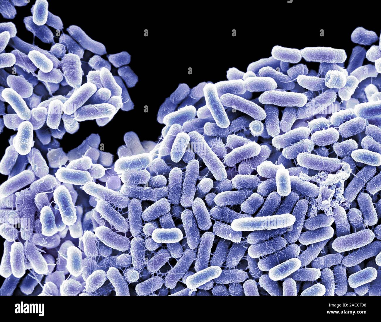 Salmonella bacteria, coloured scanning electron micrograph (SEM). These ...