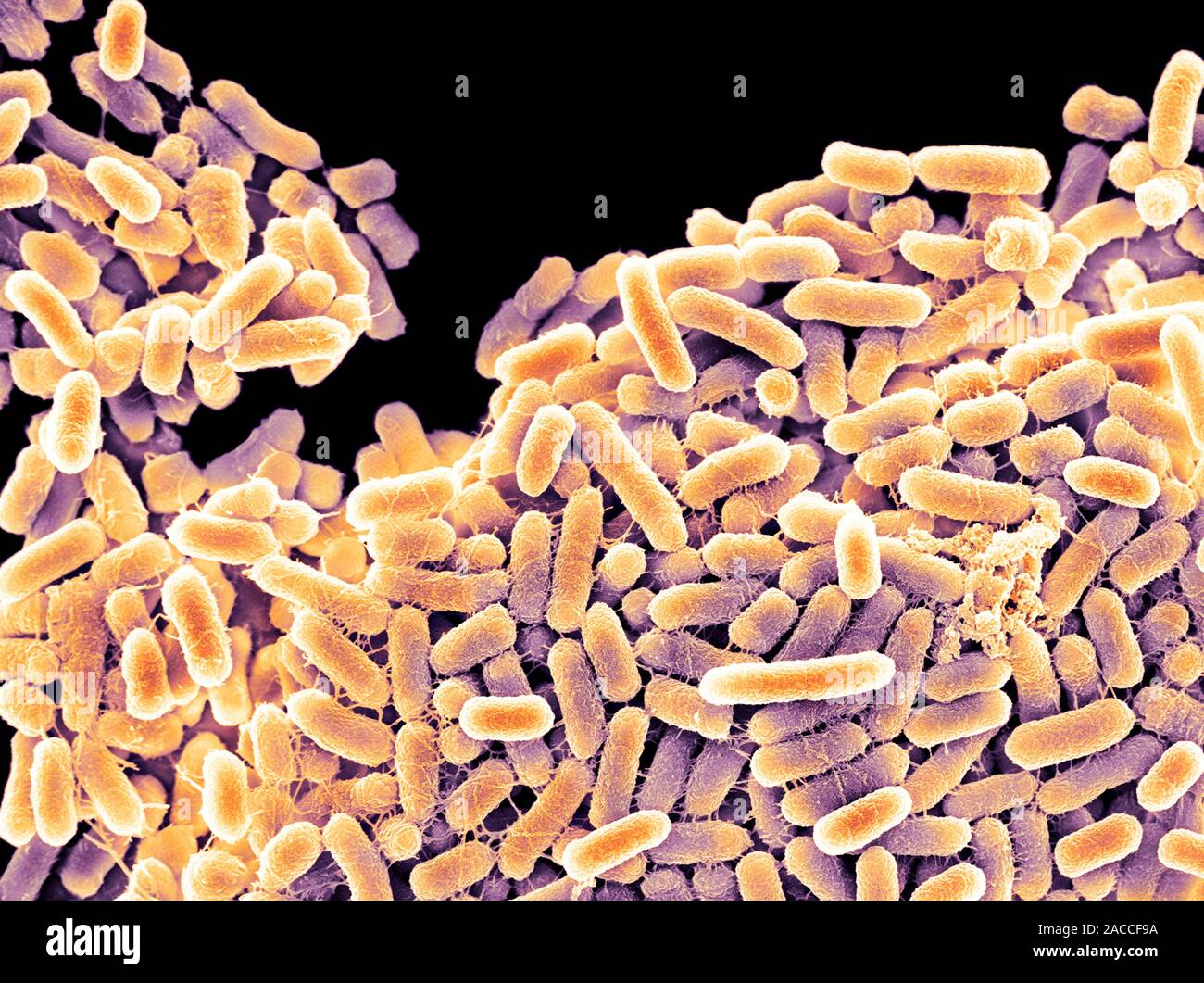 Salmonella bacteria, coloured scanning electron micrograph (SEM). These ...