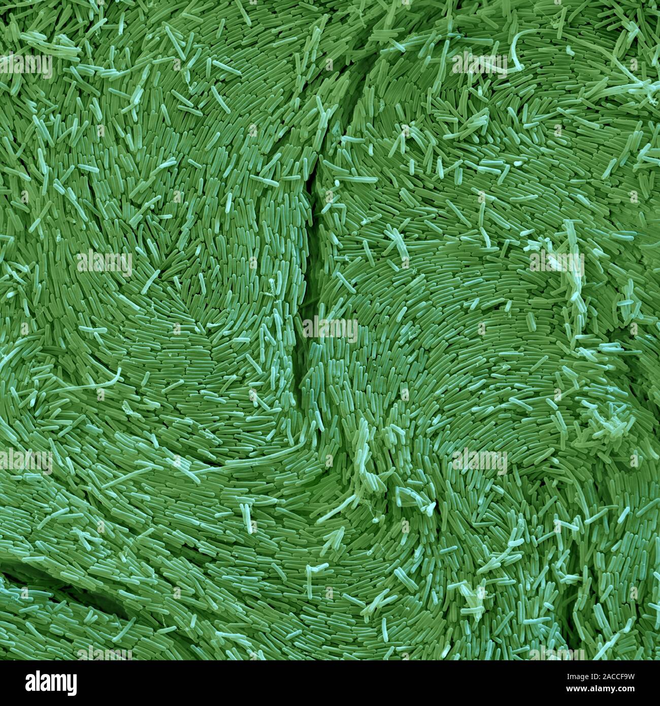 Bacillus sphaericus, coloured scanning electron micrograph (SEM). These ...