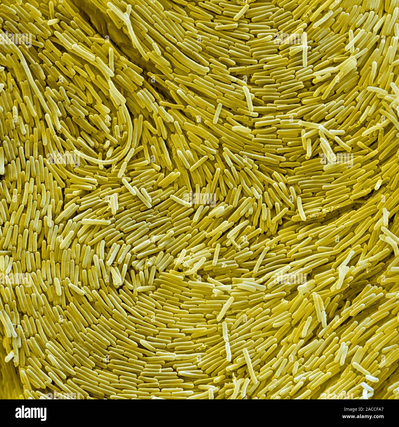 Bacillus sphaericus, coloured scanning electron micrograph (SEM). These ...