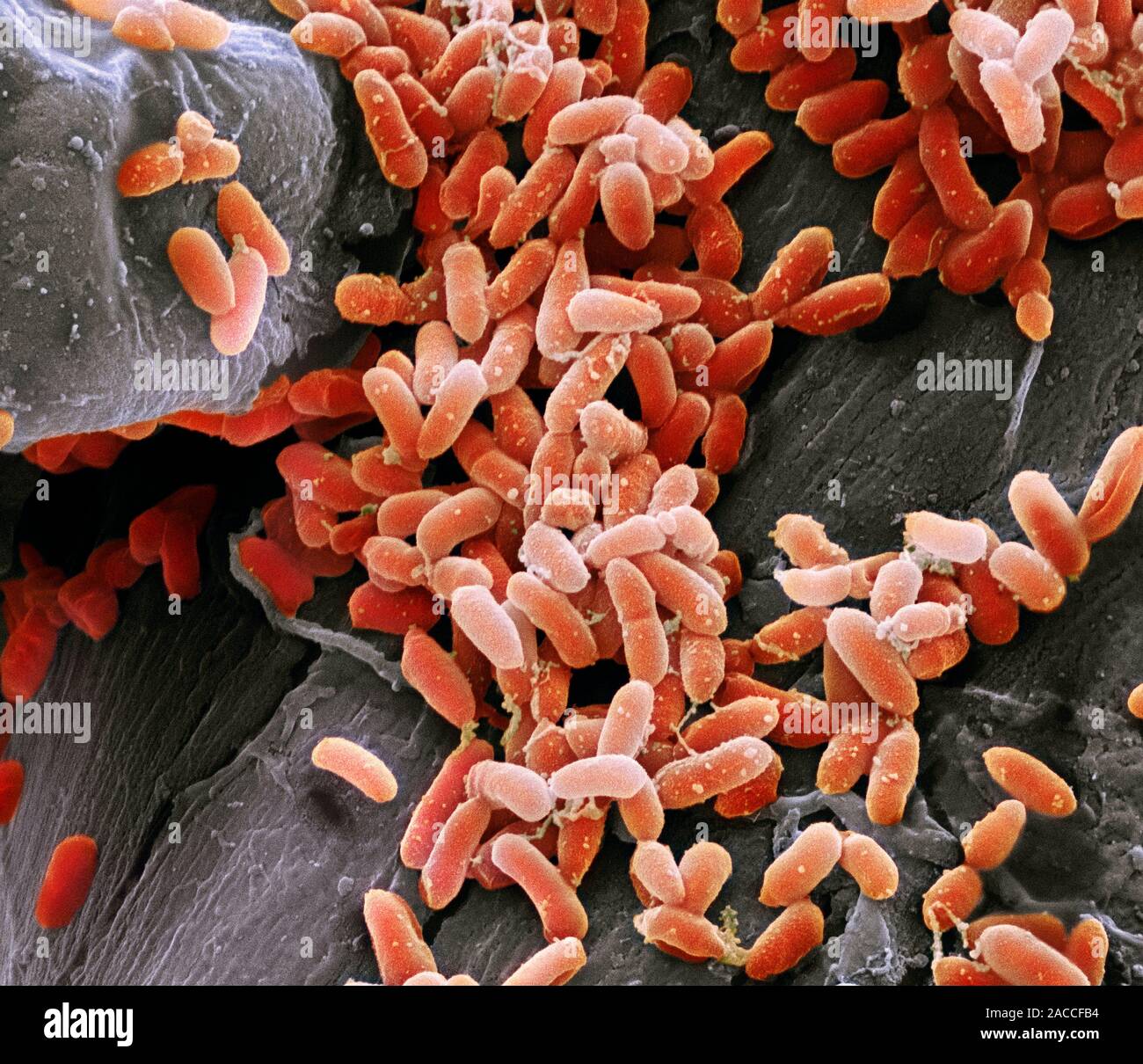Gram Stain Pseudomonas Aeruginosa