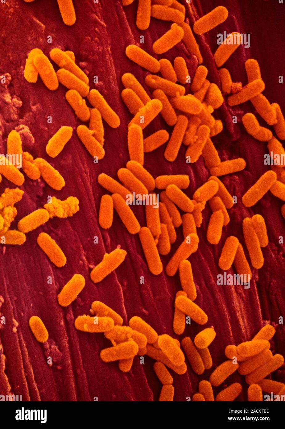 Coloured scanning electron micrograph of rod- shaped bacteria (yellow) on the head of a ...