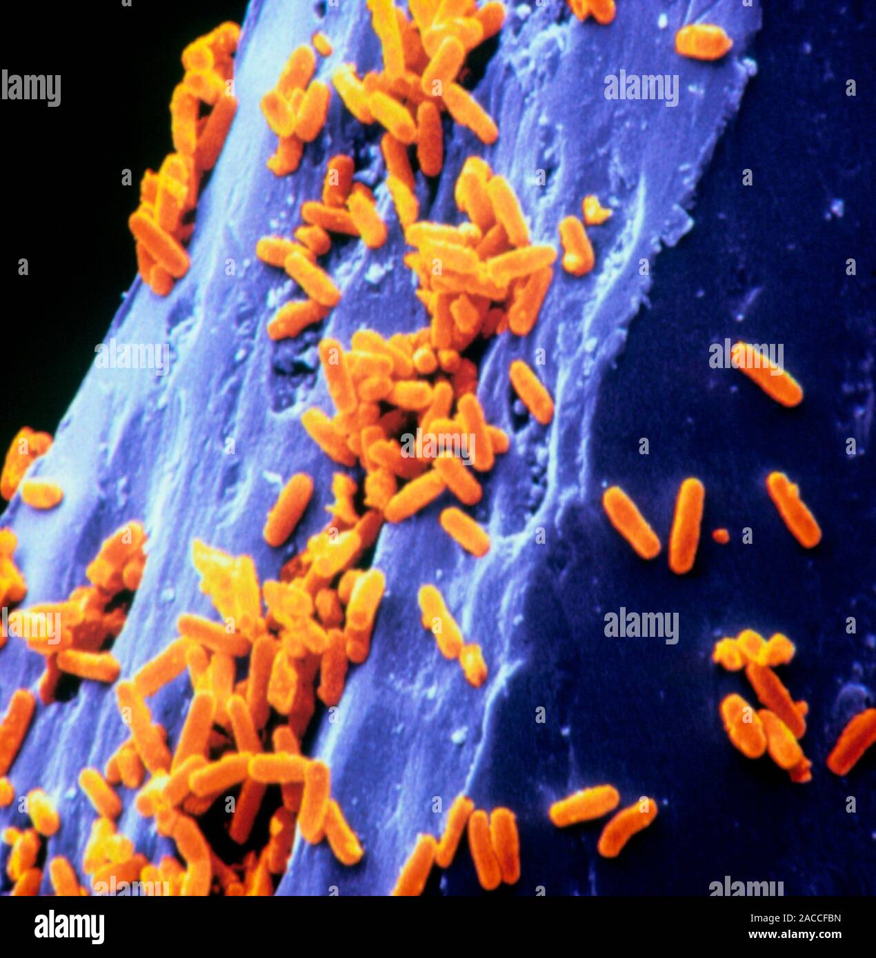 Coloured scanning electron micrograph of rod- shaped bacteria (orange ...