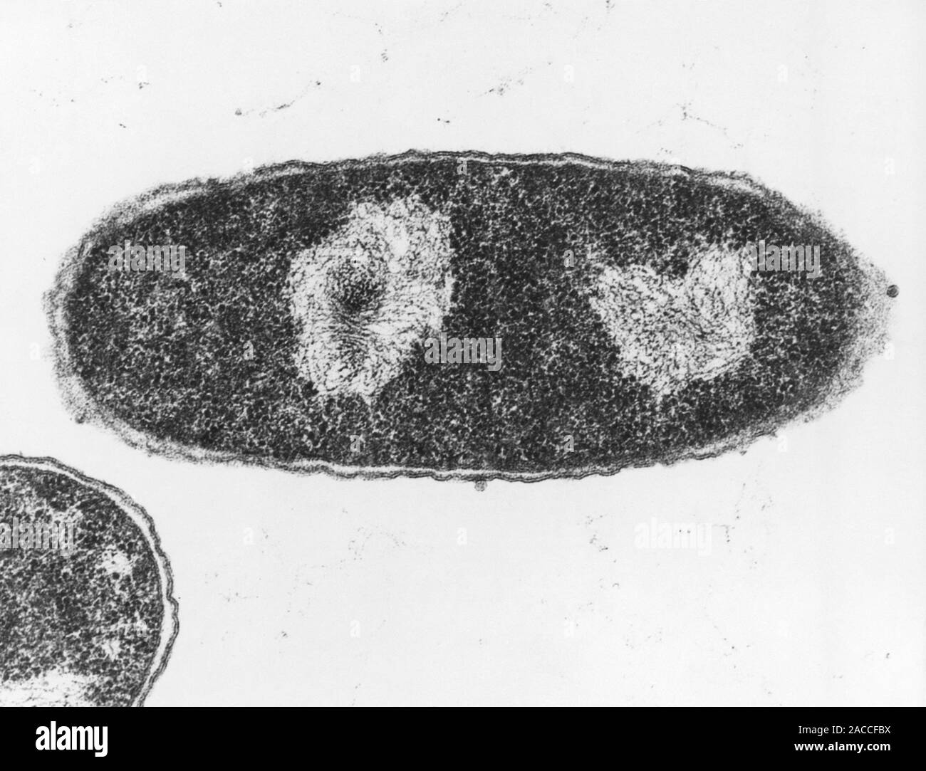 Transmisson electron micrograph of a section of the bacterium ...