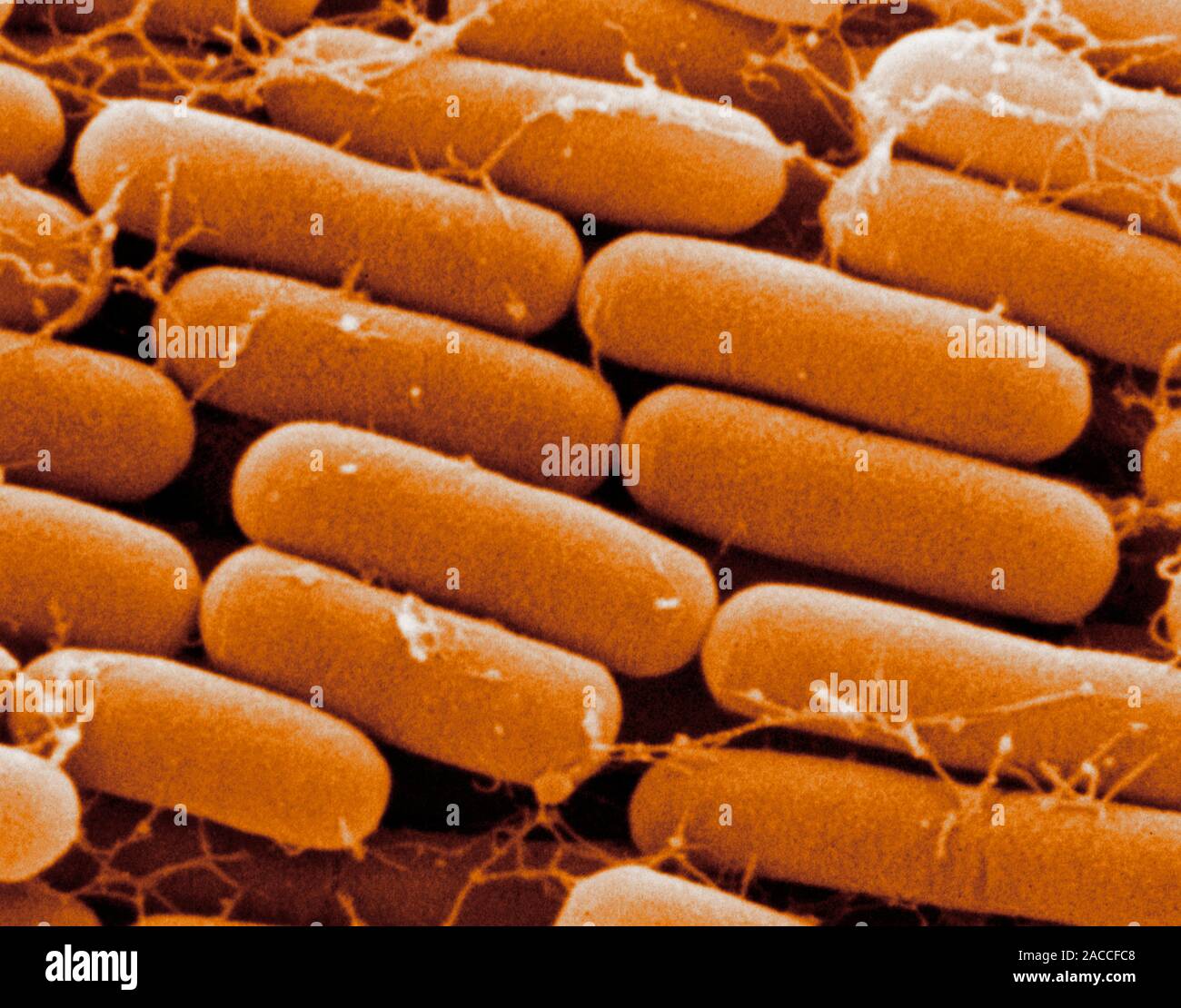 False-colour scanning electron micrograph of the rod- shaped, Gram ...