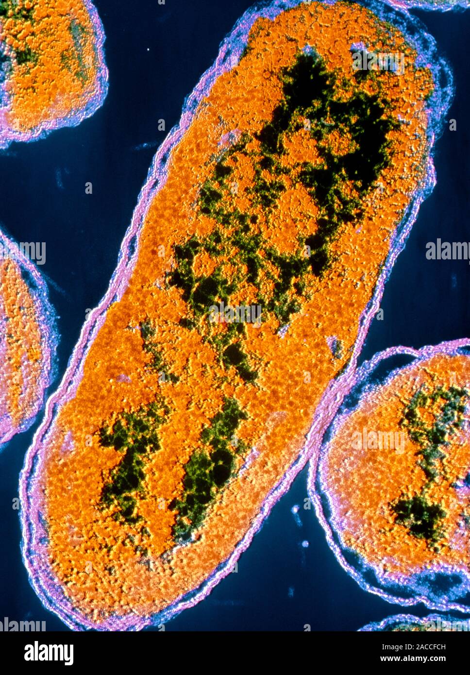 False-colour transmission electron micrograph of the rod-shaped, Gram ...