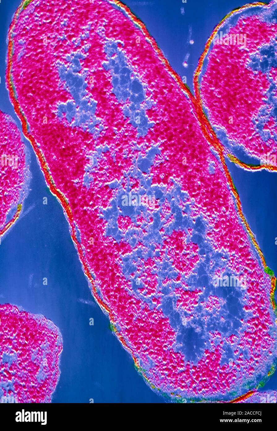 False-colour transmission electron micrograph of the rod-shaped, Gram ...