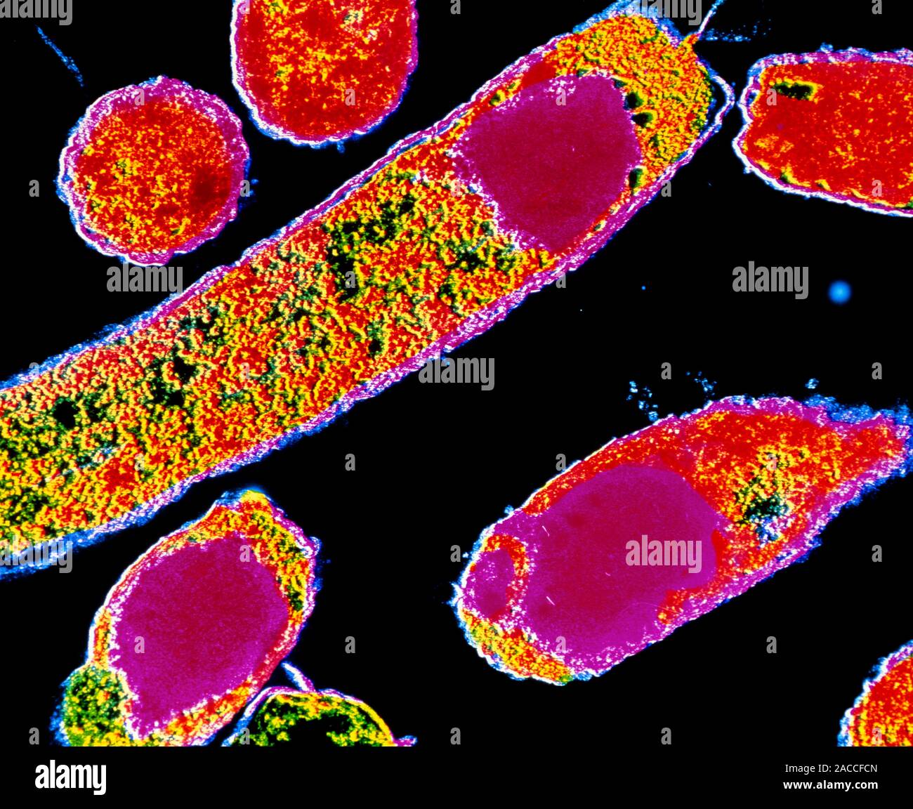 False-colour transmission electron micrograph (TEM) showing Escherichia ...
