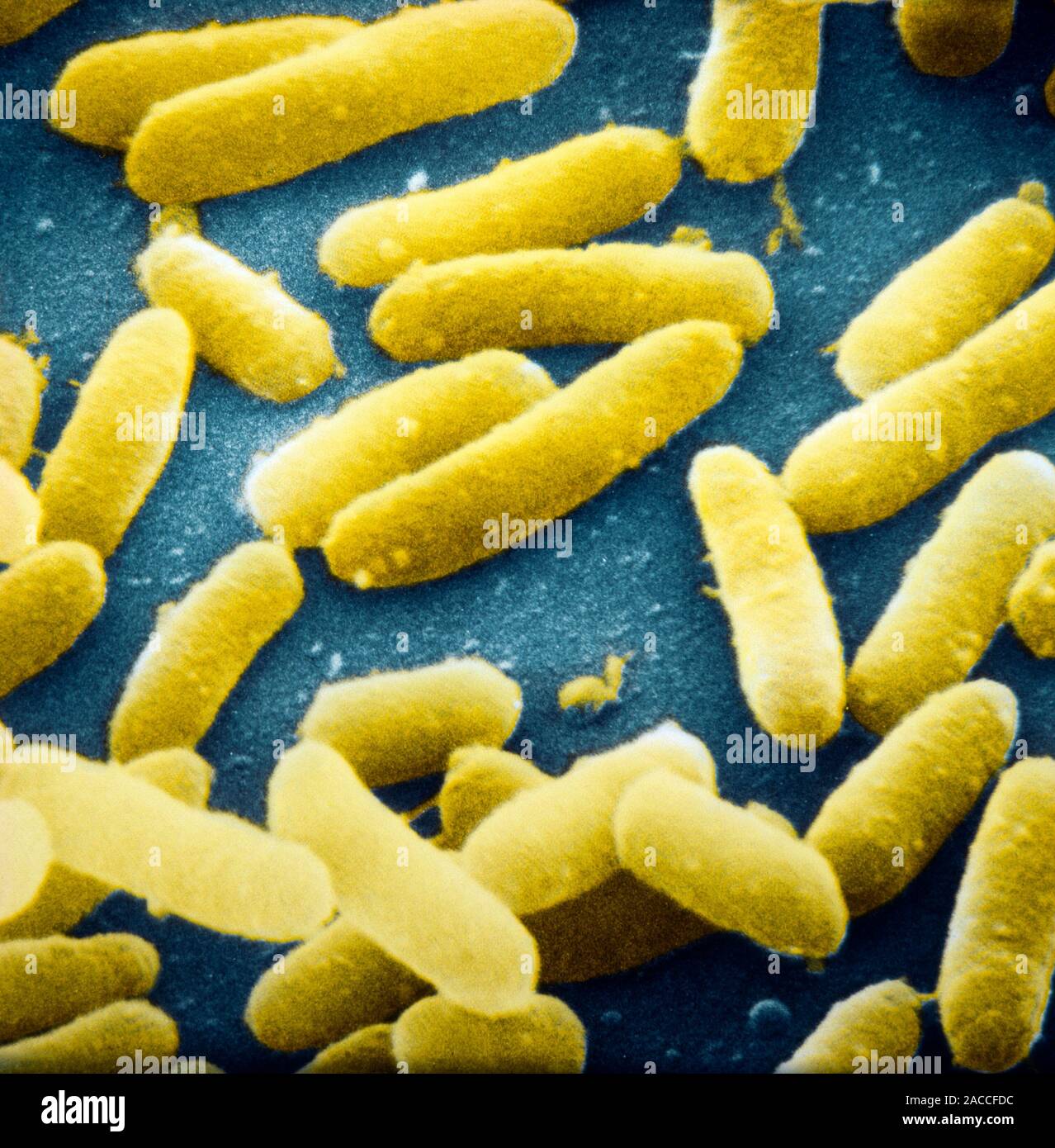 Coloured scanning electron micrograph (SEM) of the rod-shaped, Gram ...