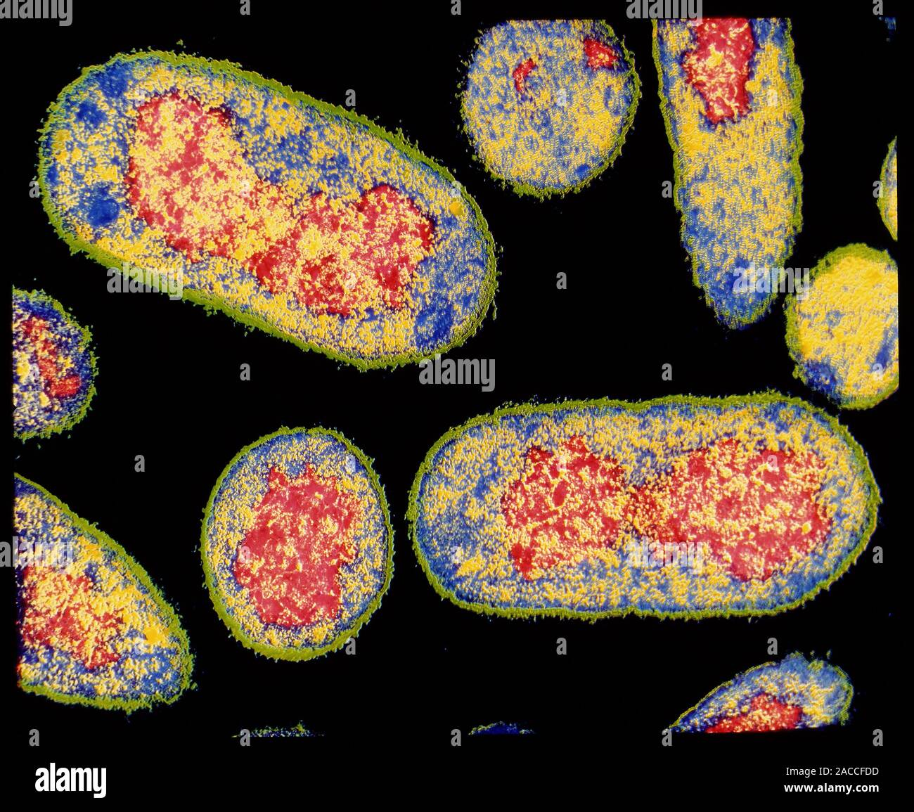 Coloured transmission electron micrograph of the rod-shaped, Gram ...