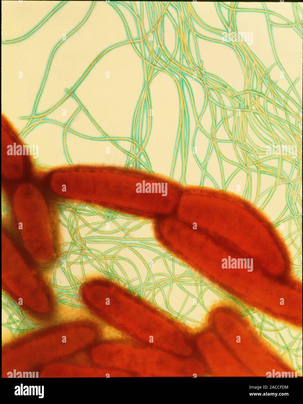Escherichia coli. Coloured Transmission Electron Micrograph (negative ... Escherichia coli. Coloured Transmission Electron Micrograph (negative ...