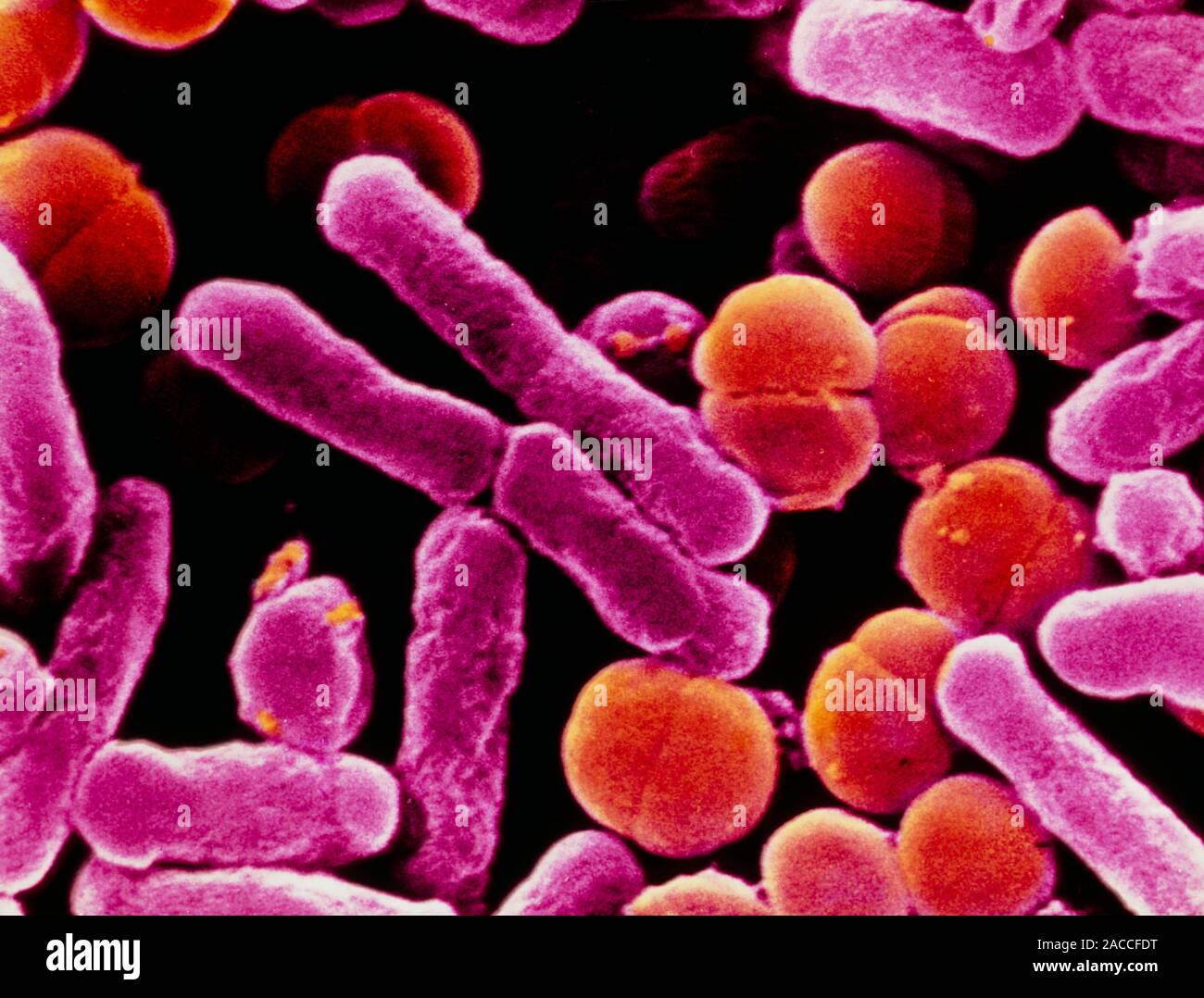 Escherichia coli & streptococcus bacteria. Coloured scanning electron ... Escherichia coli & streptococcus bacteria. Coloured scanning electron ...