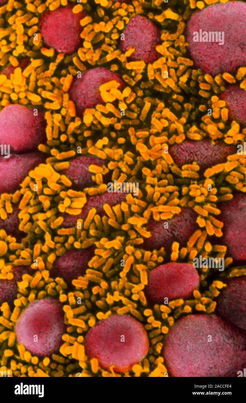 E. coli bacteria. Coloured scanning electron micrograph of rod-shaped ...