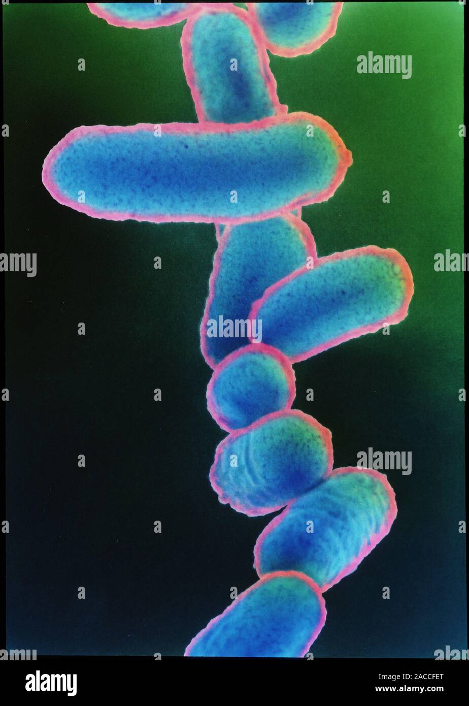 E. coli 0157:H7 bacteria. Colour scanning electron micrograph (SEM) of ...