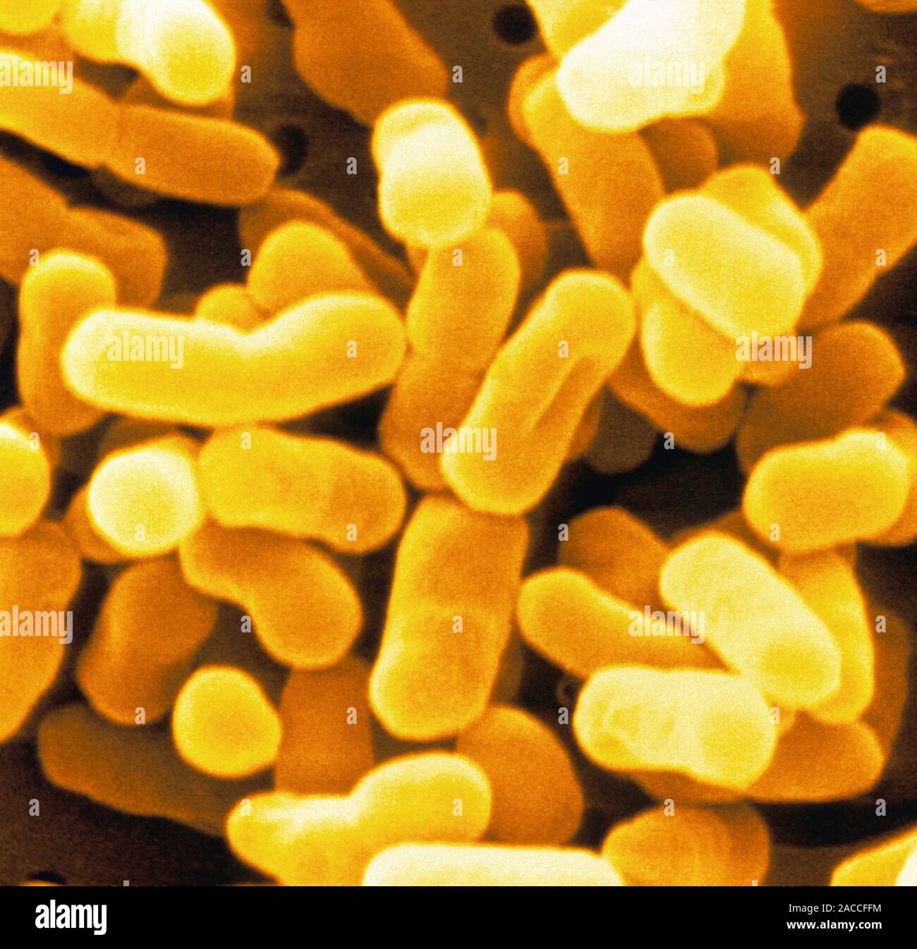 E. coli bacteria. Coloured scanning electron micrograph (SEM) of ...