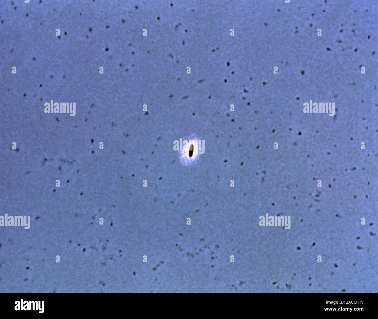 E.coli bacterium (image 1 of 14). Light micrograph of an Escherichia ...