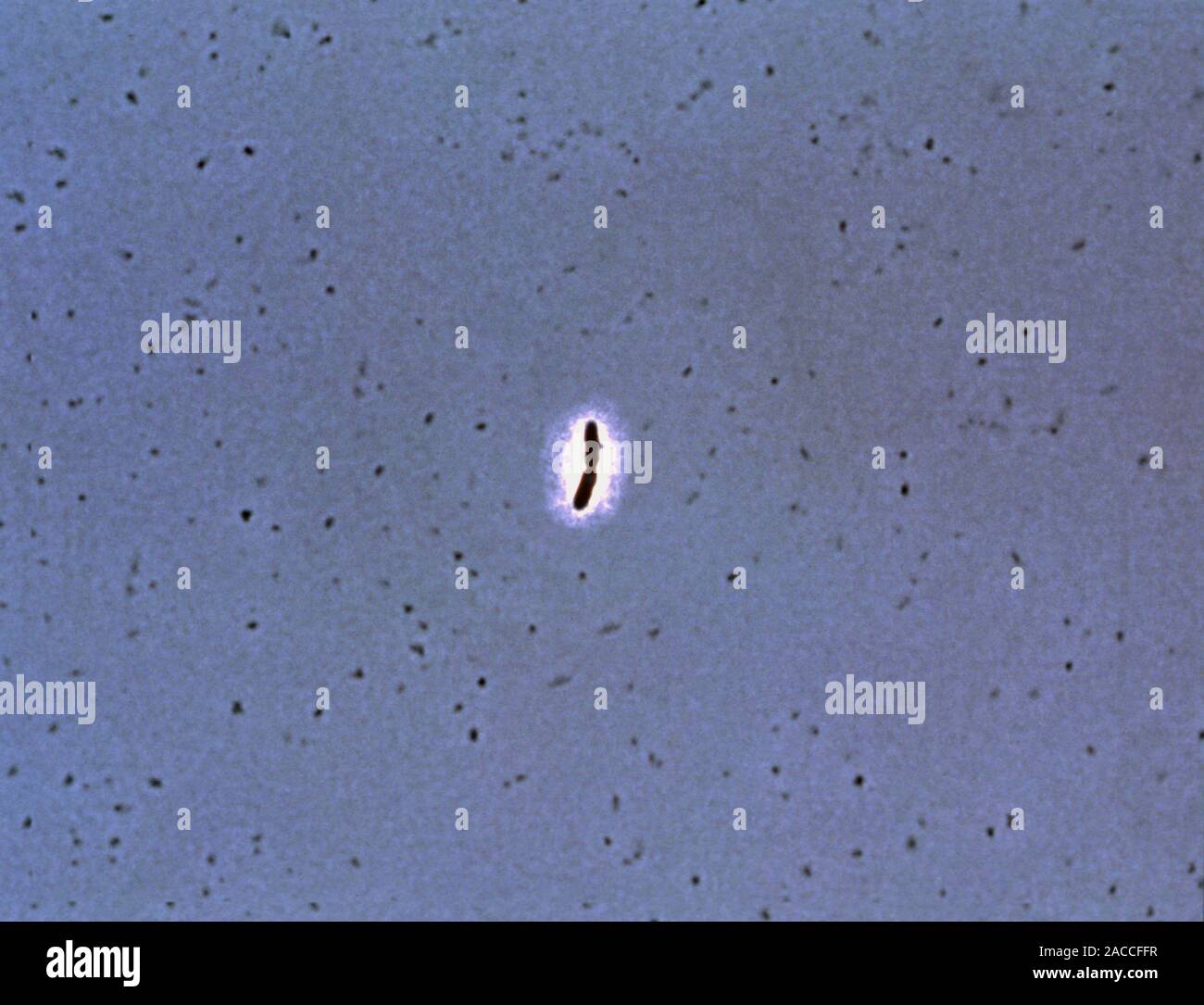 E. coli bacteria (image 2 of 14). Light micro- graph of 2 Escherichia ...