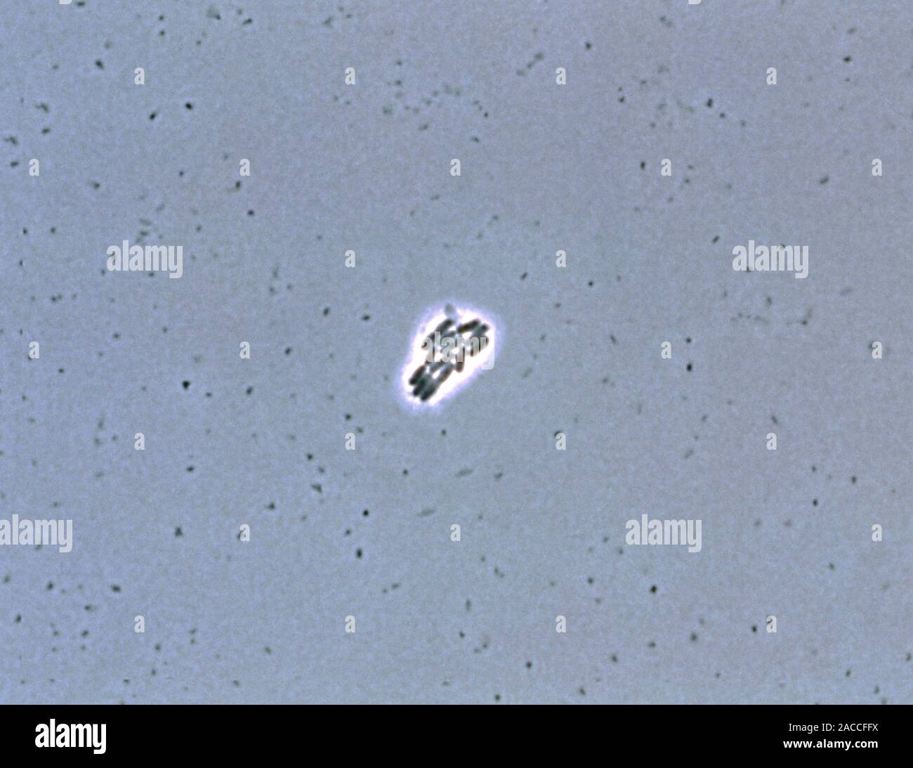 E. coli bacteria (image 5 of 14). Light micro- graph of 14 Escherichia ...