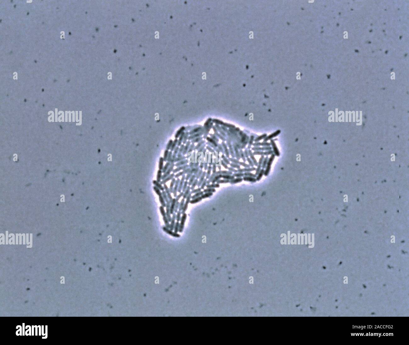 E. coli bacteria (image 9 of 14). Light micro- graph of about 200 ...