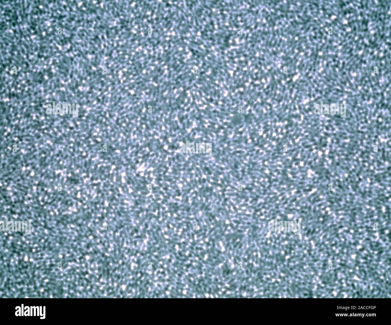 E. coli bacteria (image 14 of 14). Light micro- graph of about 8000 ...