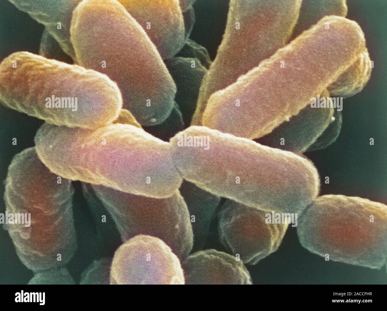 E. coli 0157:H7 bacteria. Coloured scanning electron micrograph (SEM ...
