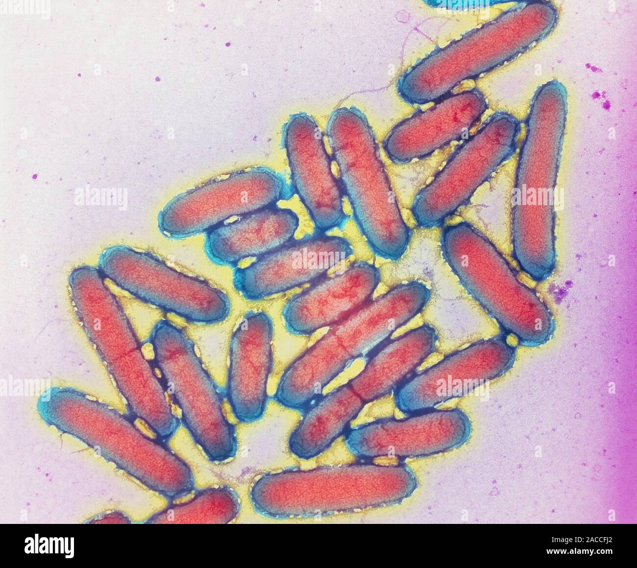 E. coli O157 bacteria. Coloured transmission electron micrograph (TEM ...