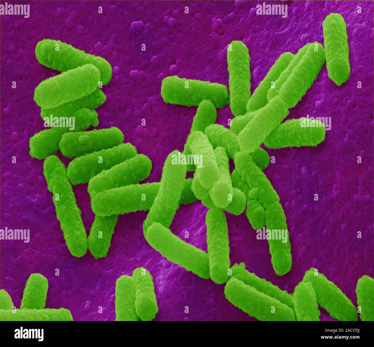 E. coli bacteria. Coloured scanning electron micrograph (SEM) of ...
