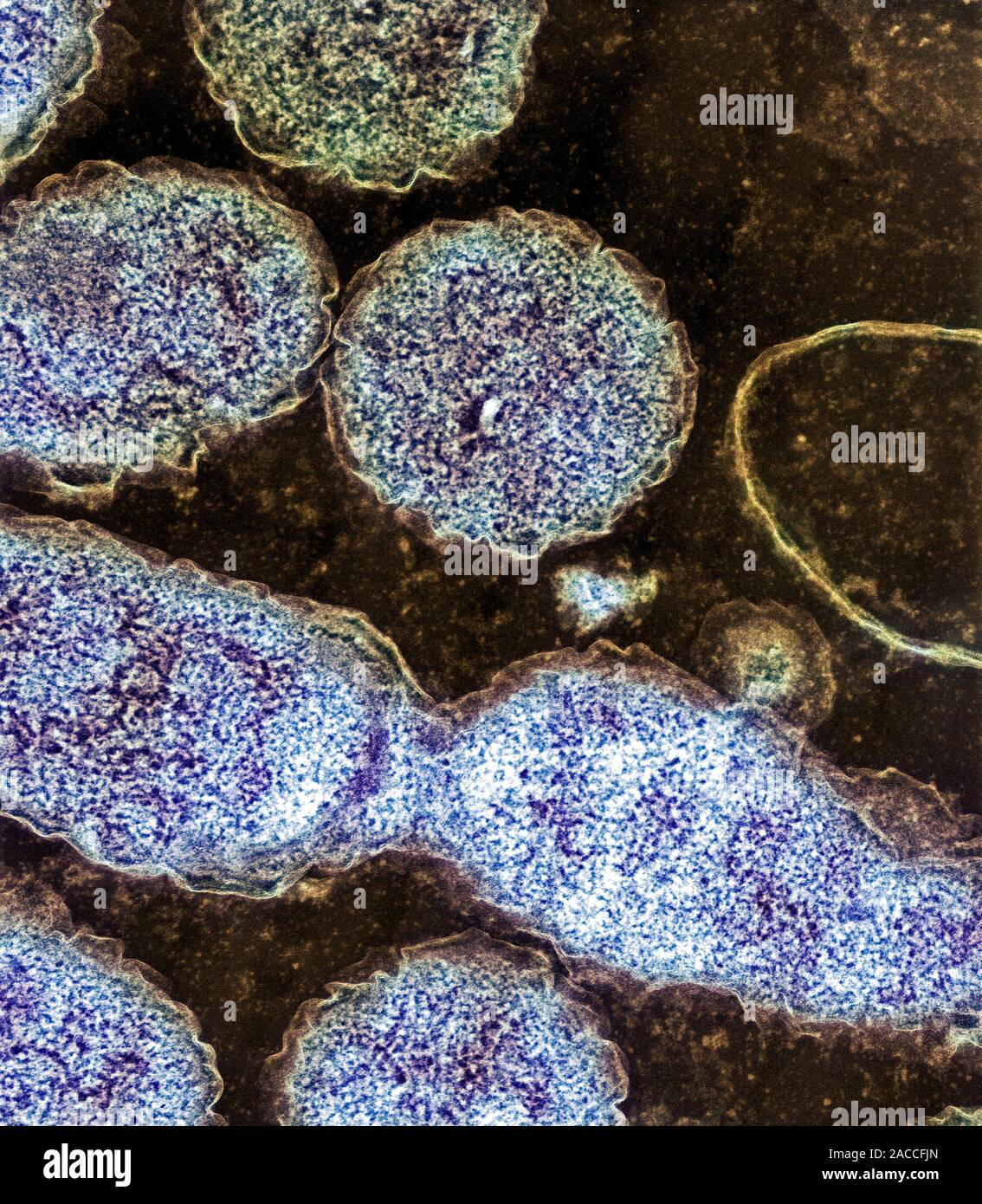 E. coli bacteria. Coloured transmission electron micrograph (TEM) of a ...