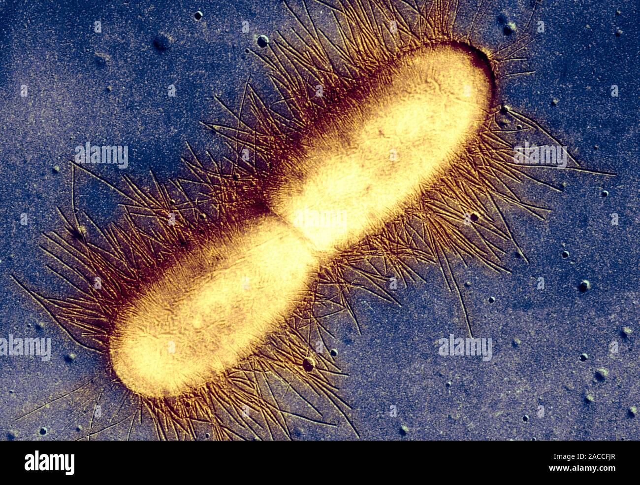 E Coli Bacterium Coloured Transmission Electron Micrograph Tem Of An Escherichia Coli E