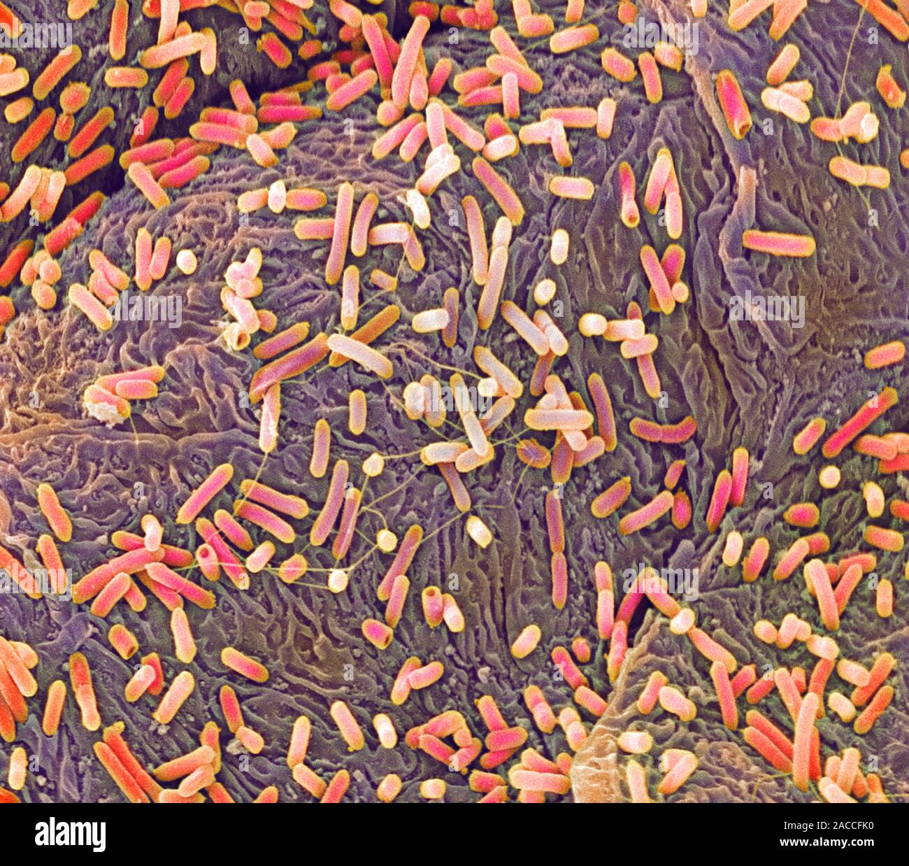 E. coli bacteria. Coloured scanning electron micrograph (SEM) of ...