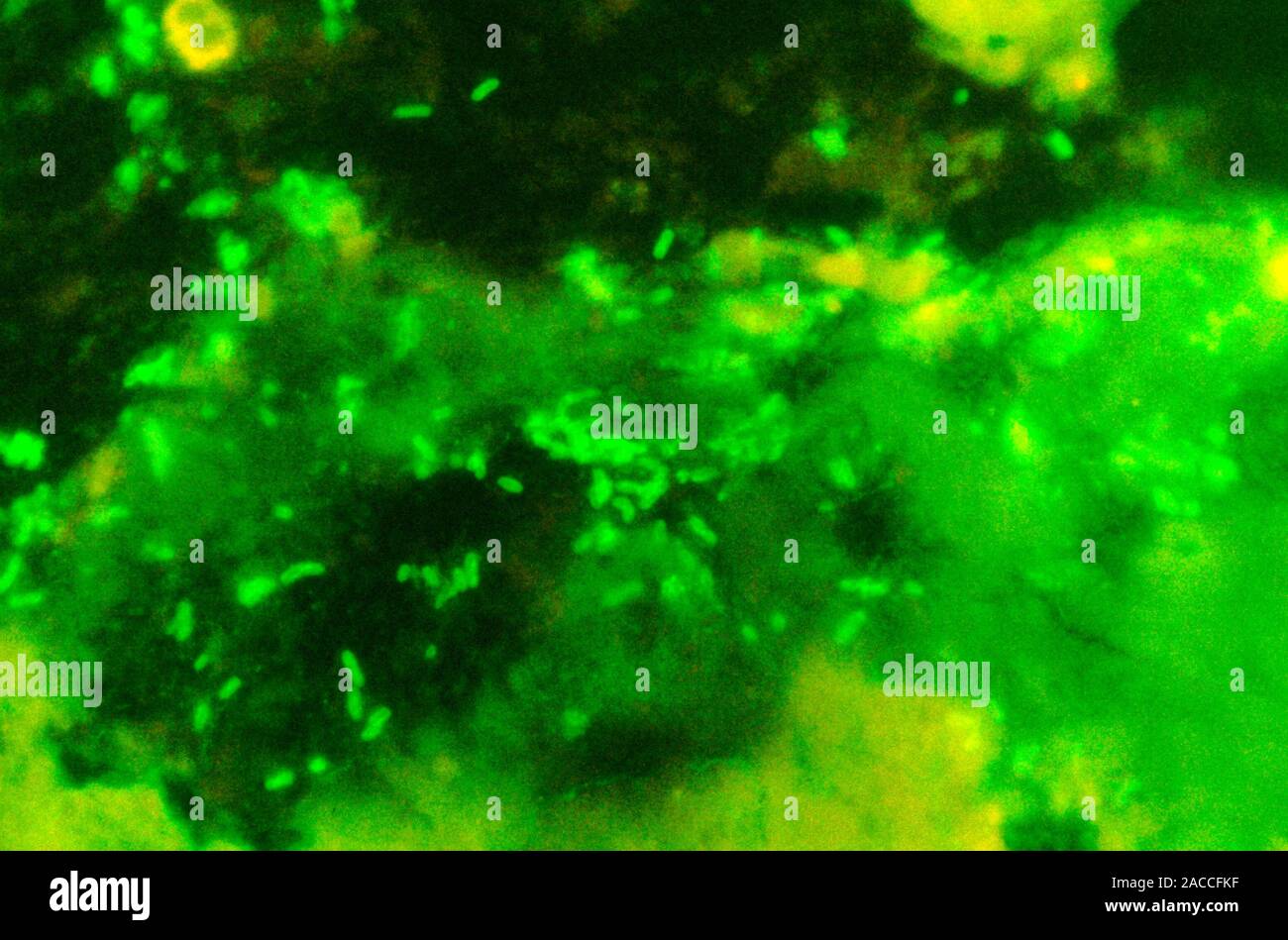 E. coli. Fluorescent light micrograph of Escherichia coli bacteria ...
