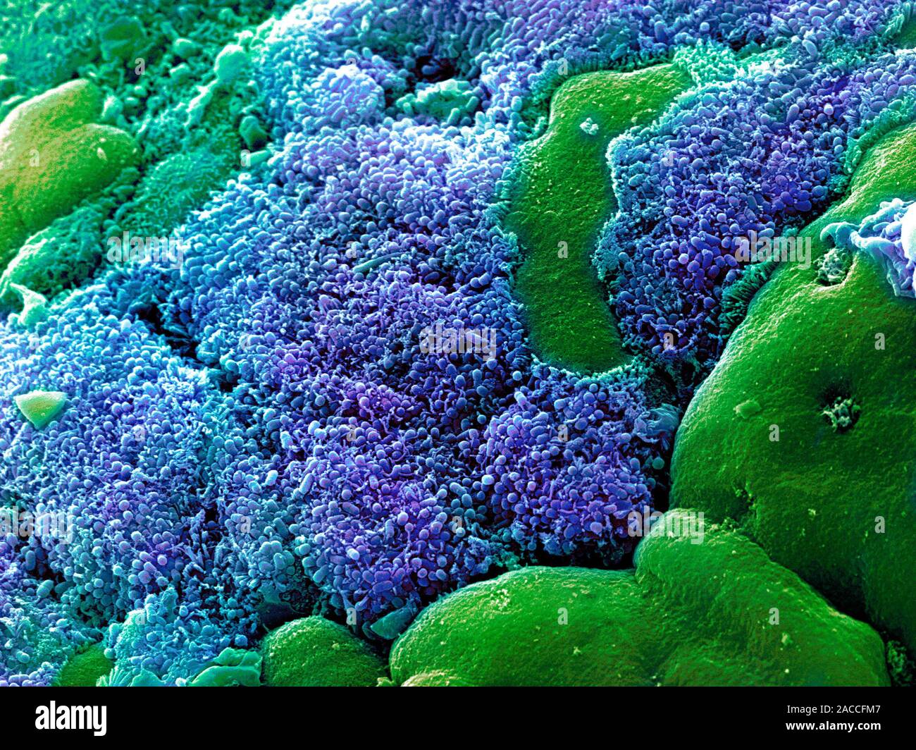 E. coli bacteria. Coloured scanning electron micrograph (SEM) of ...