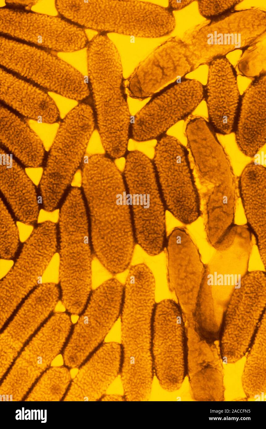 False Colour Transmission Electron Micrograph Tem Of The Gram Negative Bacterium Legionella