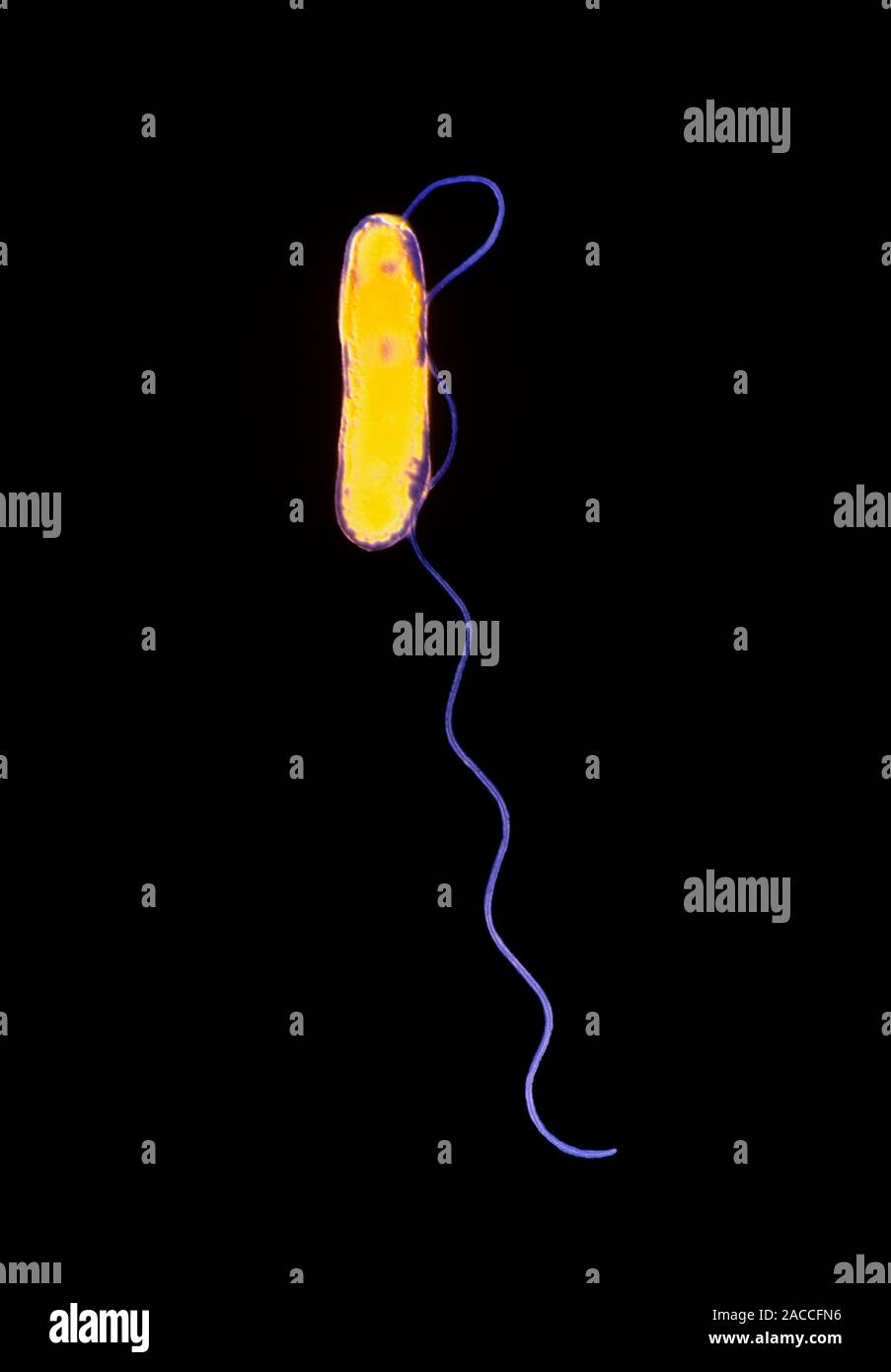 False Colour Transmission Electron Micrograph Of The Gram Negative Bacterium Legionella