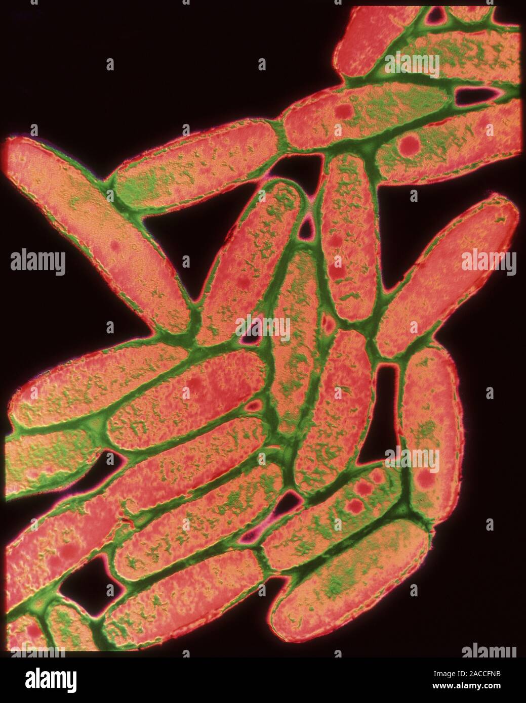 Legionella. Coloured transmission electron micrograph of the bacteria ...