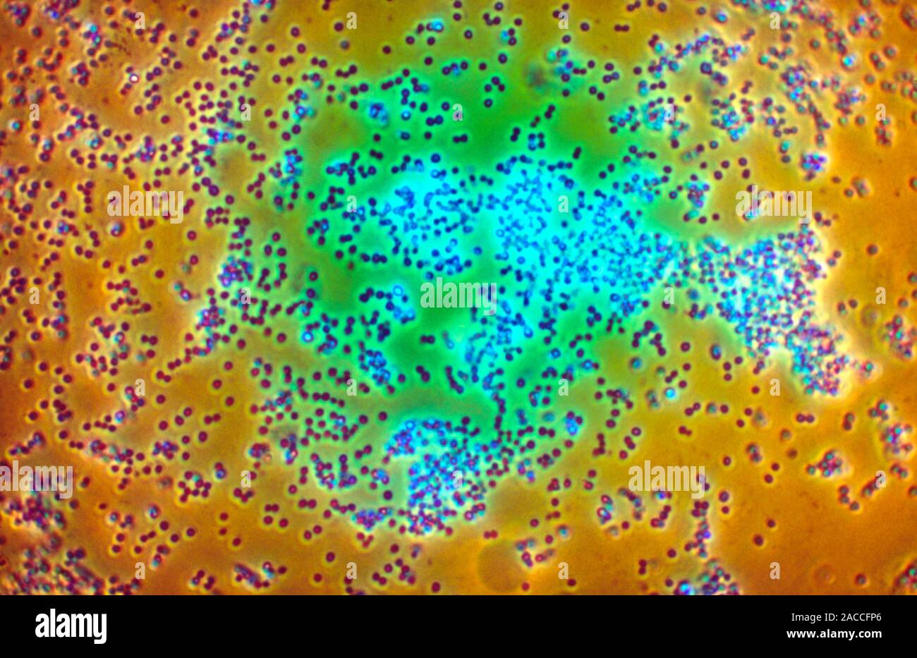 Light micrograph of the spherical bacteria, Staphylococcus aureus (gram ...