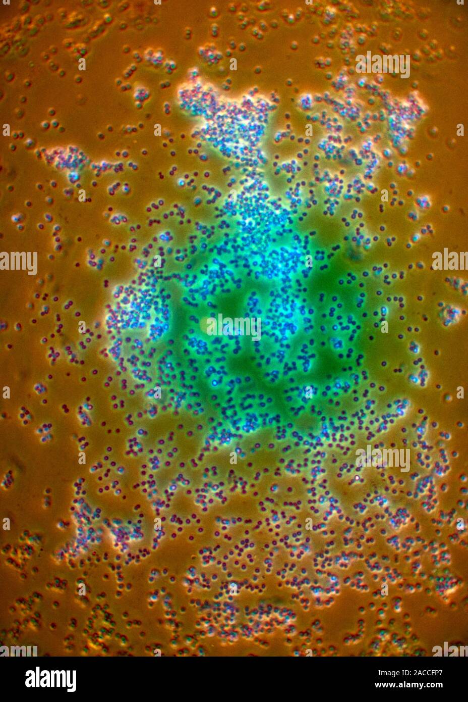 Phase contrast light micrograph of a group of Staphylococcus aureus, a ...