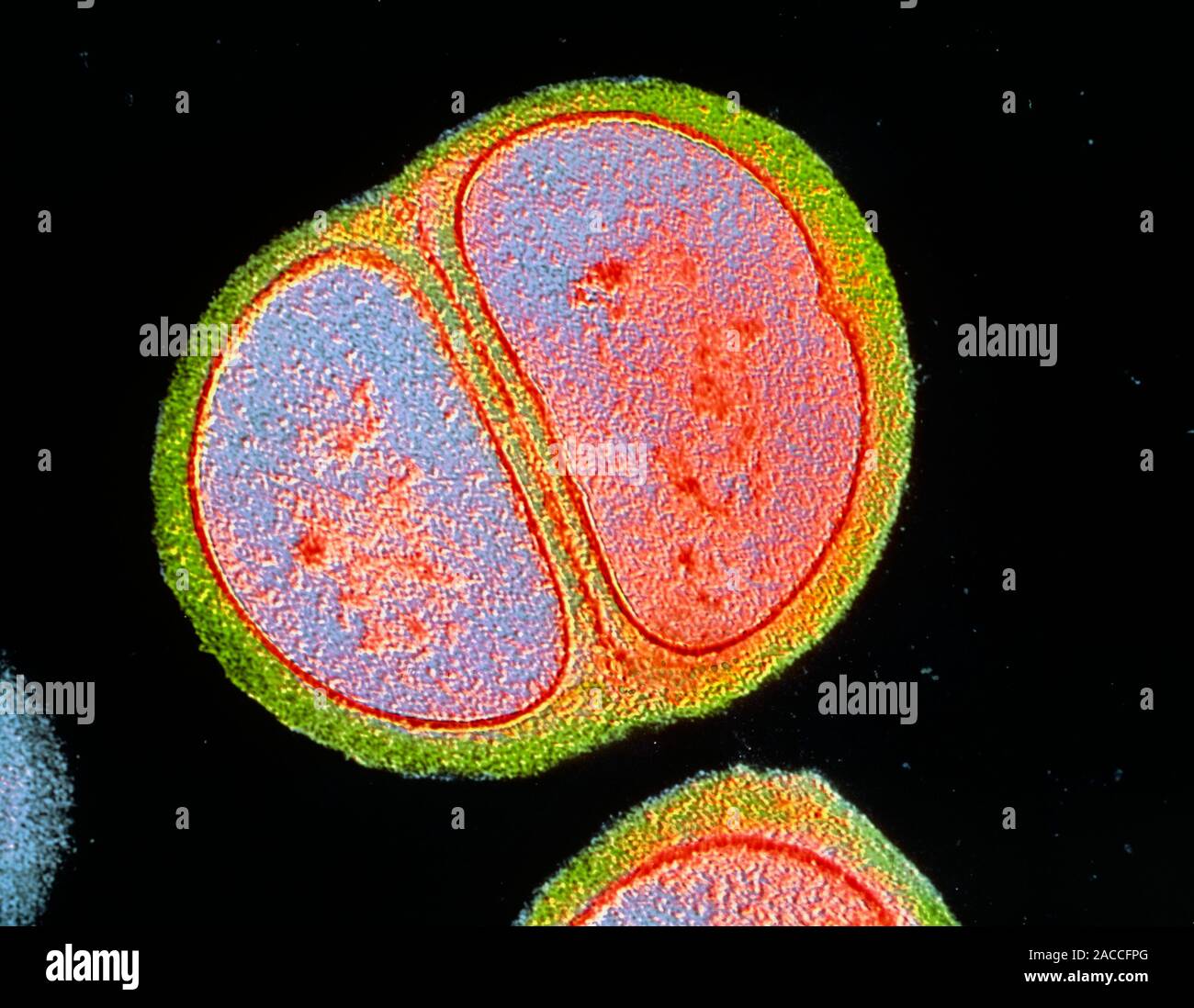 False Colour Transmission Electron Micrograph Tem Of A Single Bacterium Of Staphylococcus
