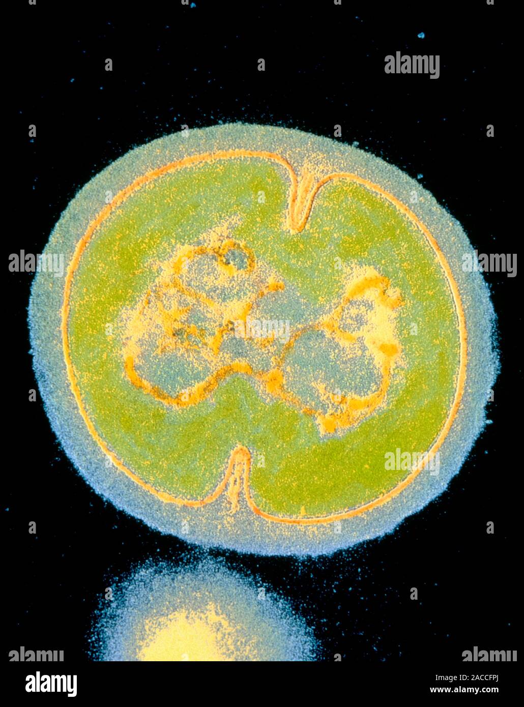False Colour Transmission Electron Micrograph Of A Coccoid Bacterium Staphylococcus Epidermidis