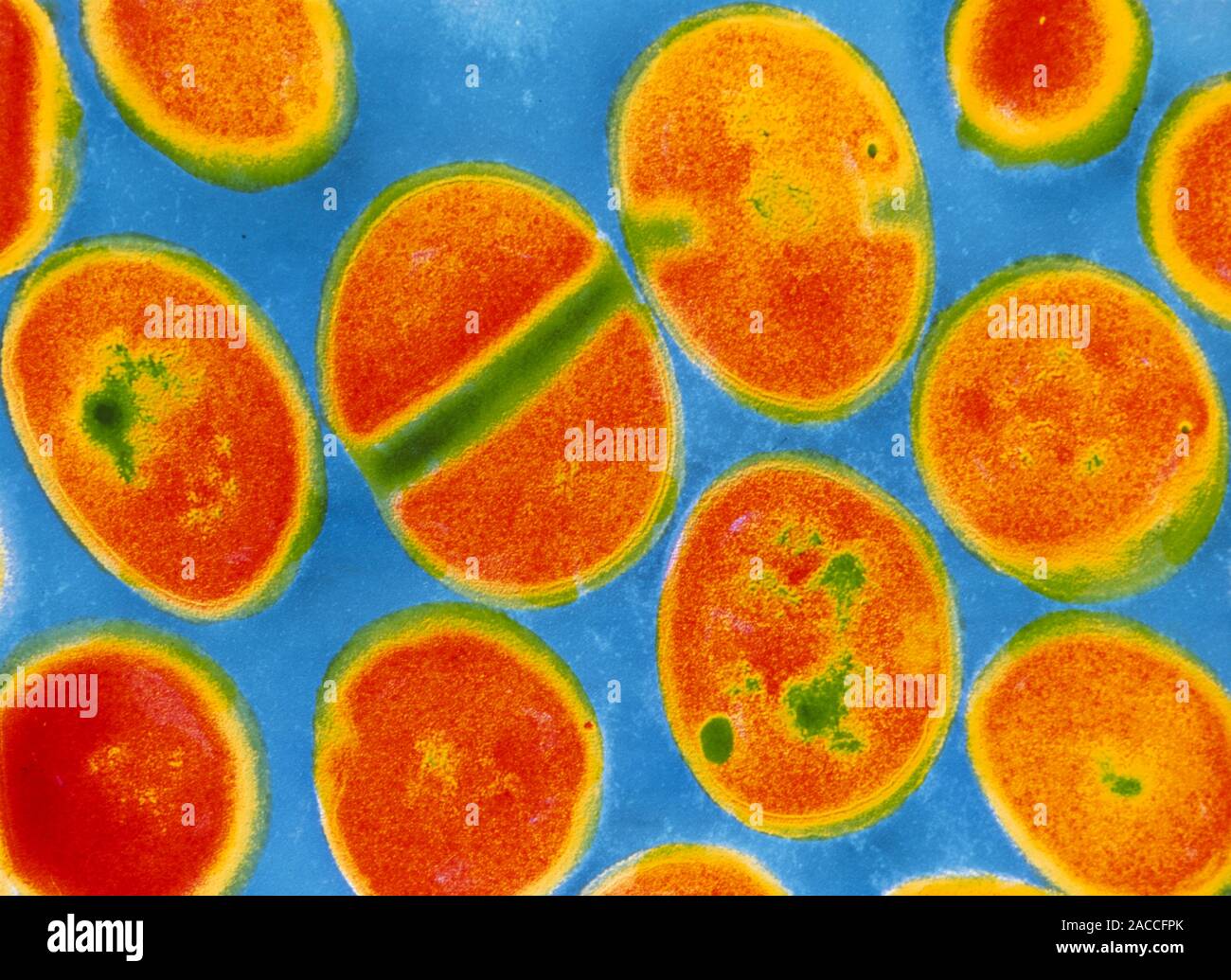 False-colour transmission electron micrograph (TEM) of a colony of ...