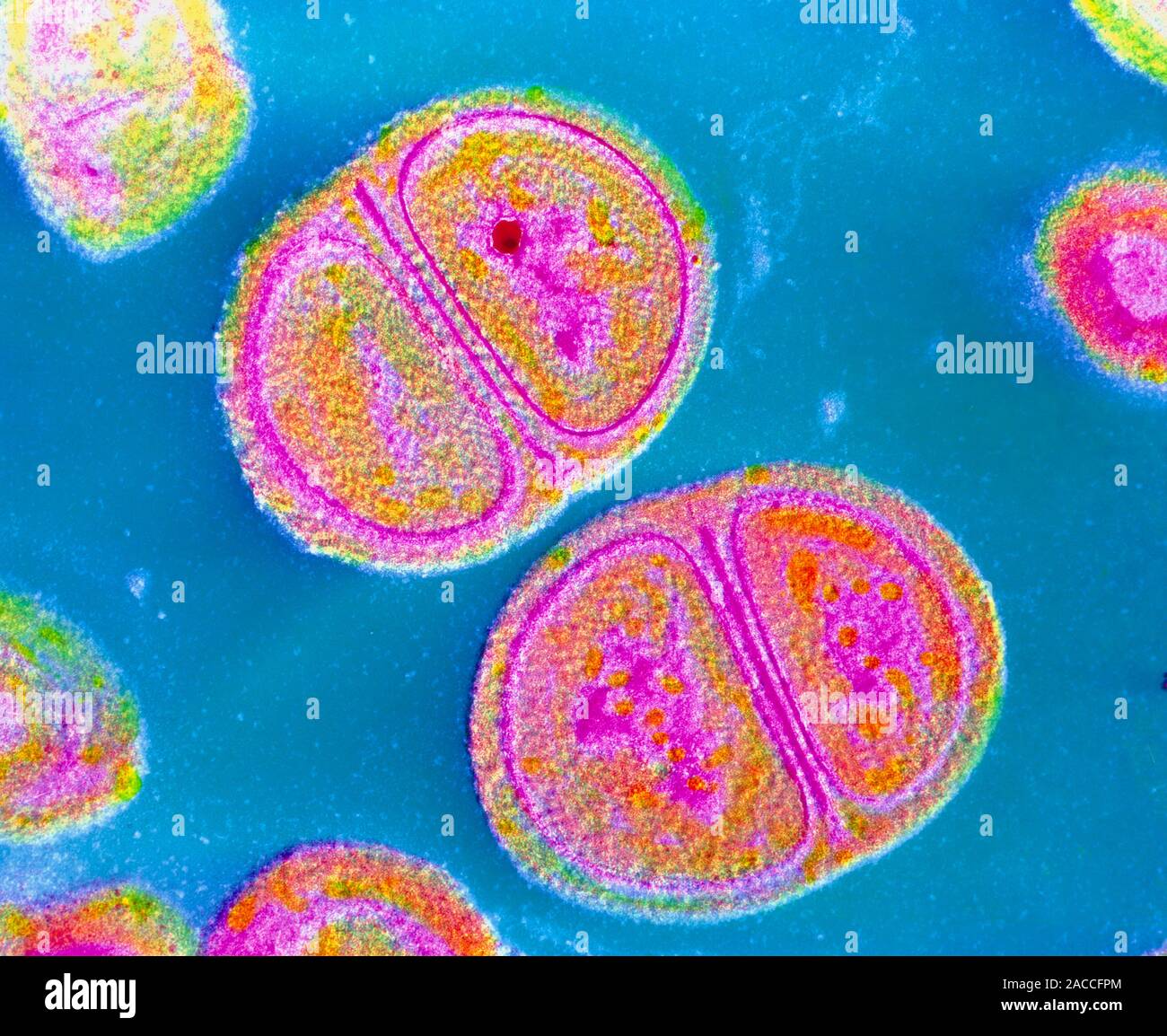 False-colour transmission electron micrograph (TEM) of Staphylococcus ...